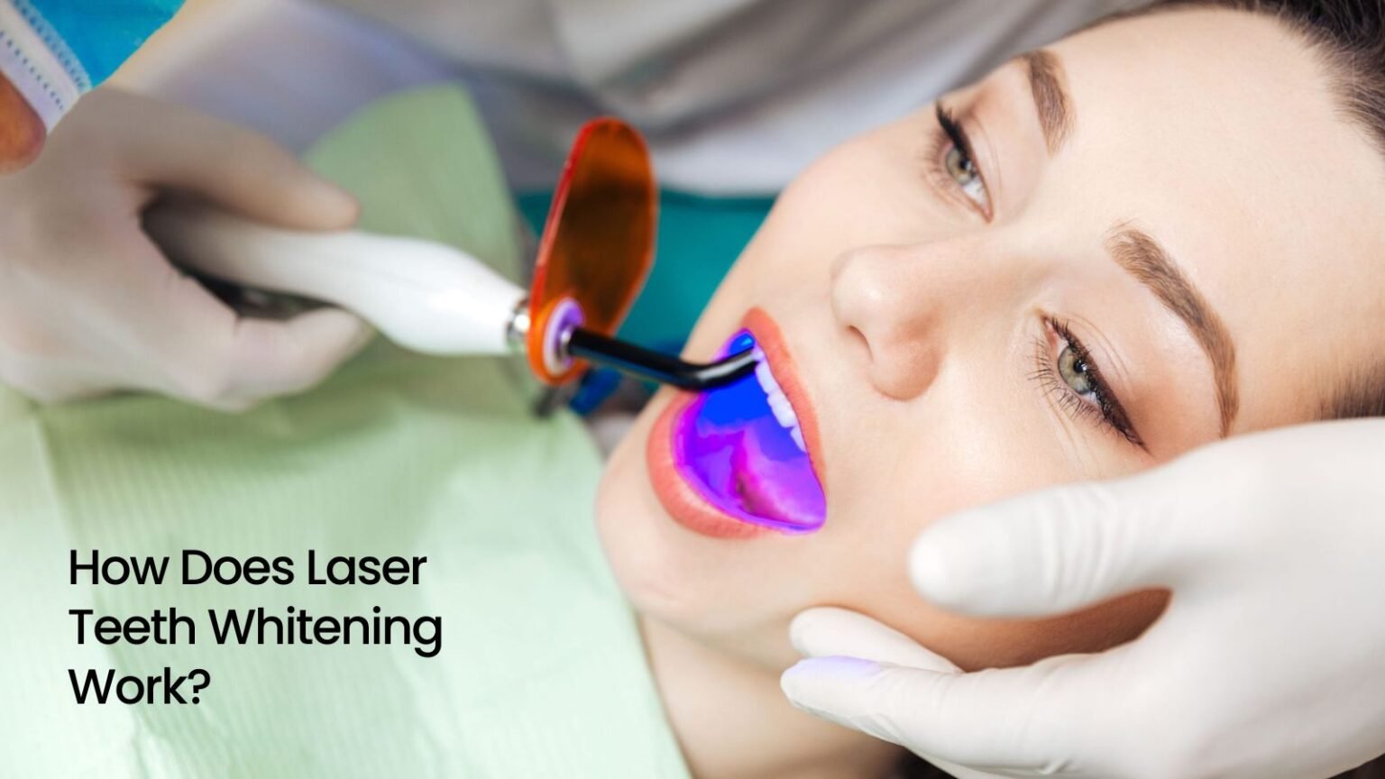 How Does Laser Teeth Whitening Work? | FaceKraft Dental Implant Clinic