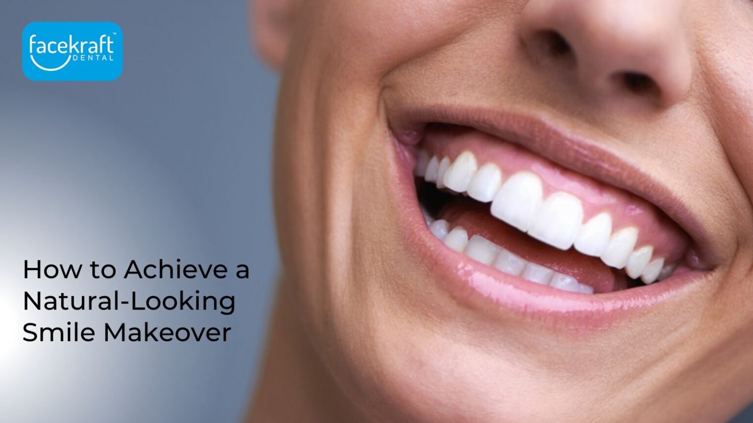 How to Achieve a Natural-Looking Smile Makeover - Face Kraft Clinic